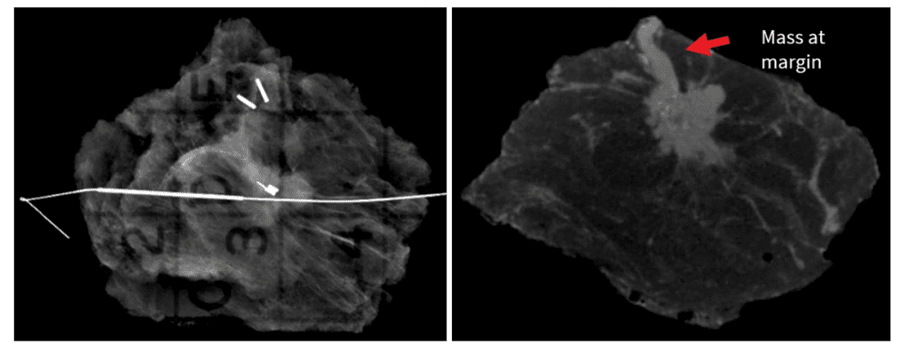 Clarix Imaging Addresses Unmet Needs with Novel Imaging-Based Solution ...