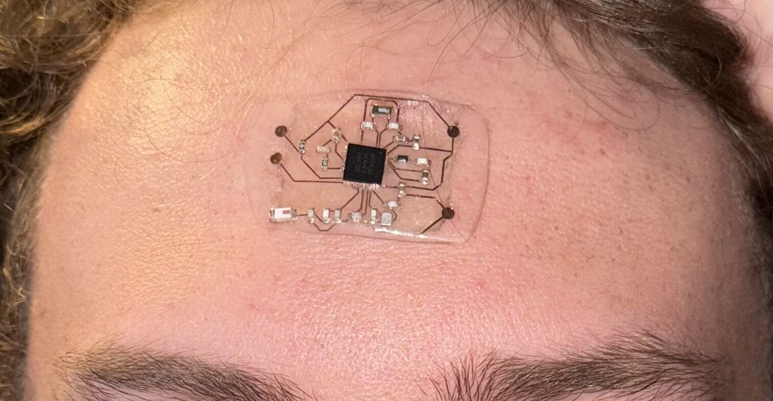 How Theta Neurotech is Making Seizure Prediction Possible - Polsky ...